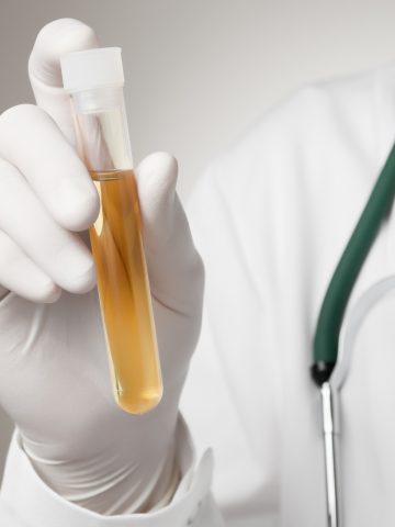 7 Tips For Taking Your Dog's Urine Sample To The Vet